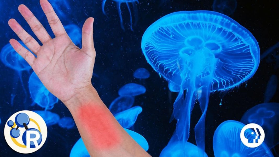 What to do if you are stung by a jellyfish in Spain - Olive Press News ...