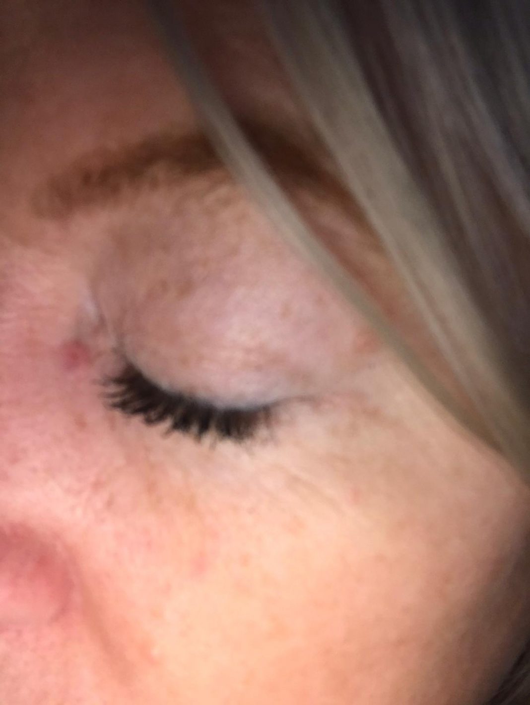 British optician on Spain’s Costa Blanca helps detect cancerous ‘rodent ...