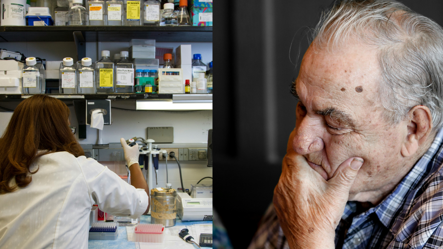 FROM THE ARCHIVES: Alzheimer’s revelation: How the brain disease was ...