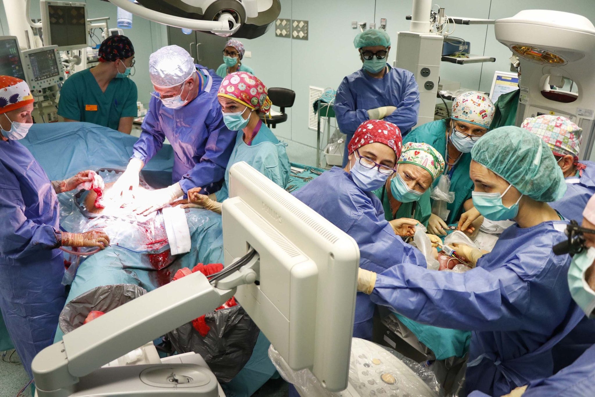 Surgeons remove heart tumour from baby weighing under a kilo in first operation of its kind in ...