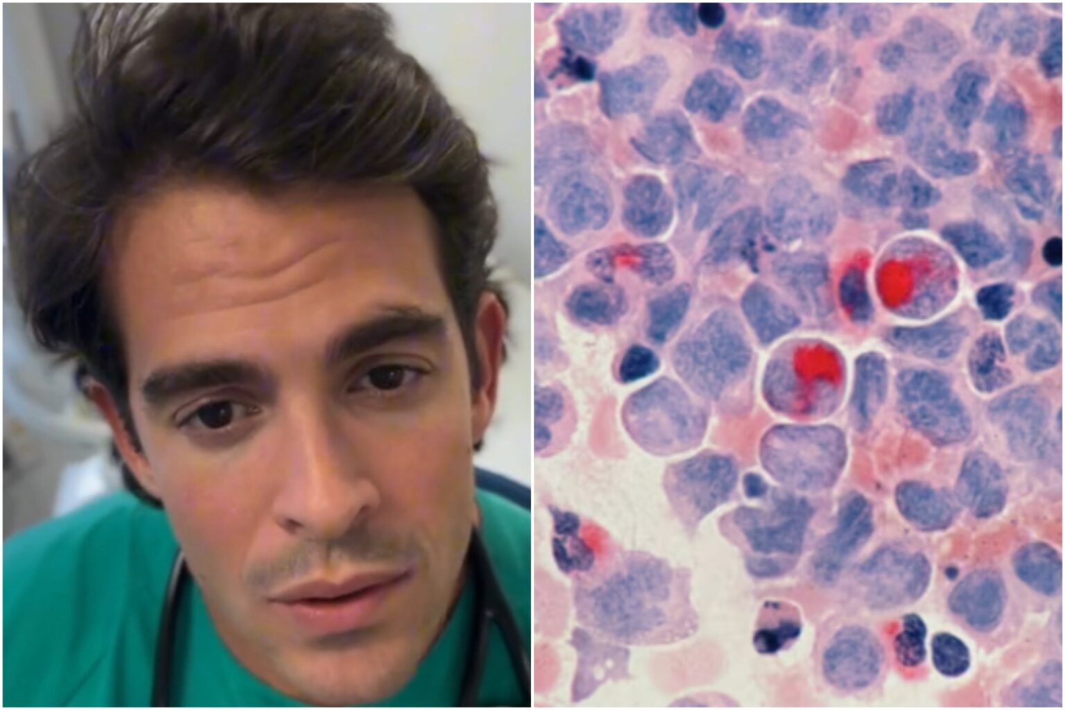 Spanish doctor warns of the 'silent killers’ causing a steep rise in ...