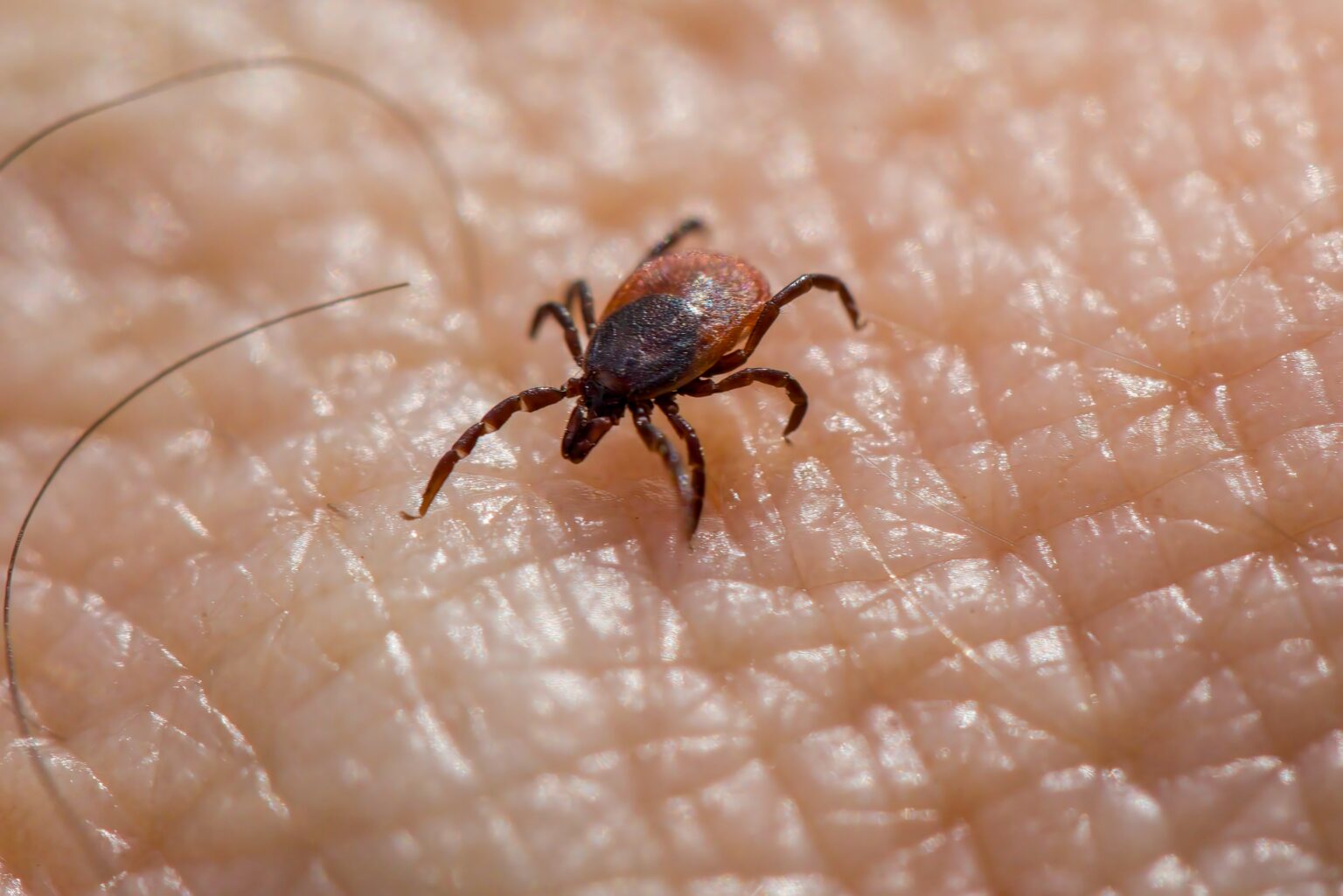 Man quarantined in Spain over tick-borne disease from Africa's Congo ...