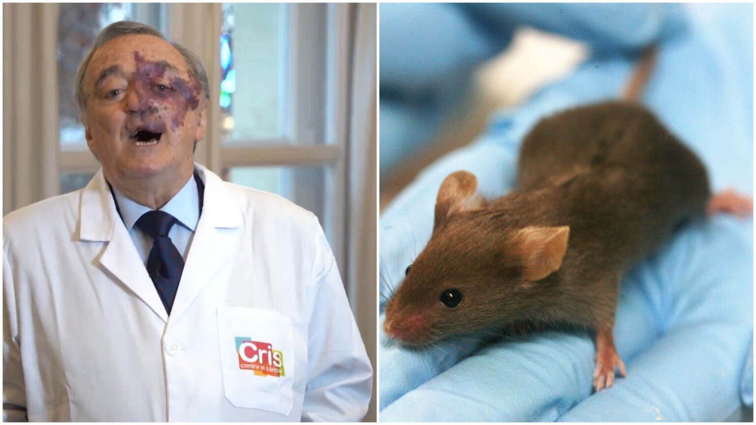 Spanish scientists cure pancreatic cancer in mice - raising hopes for a ...